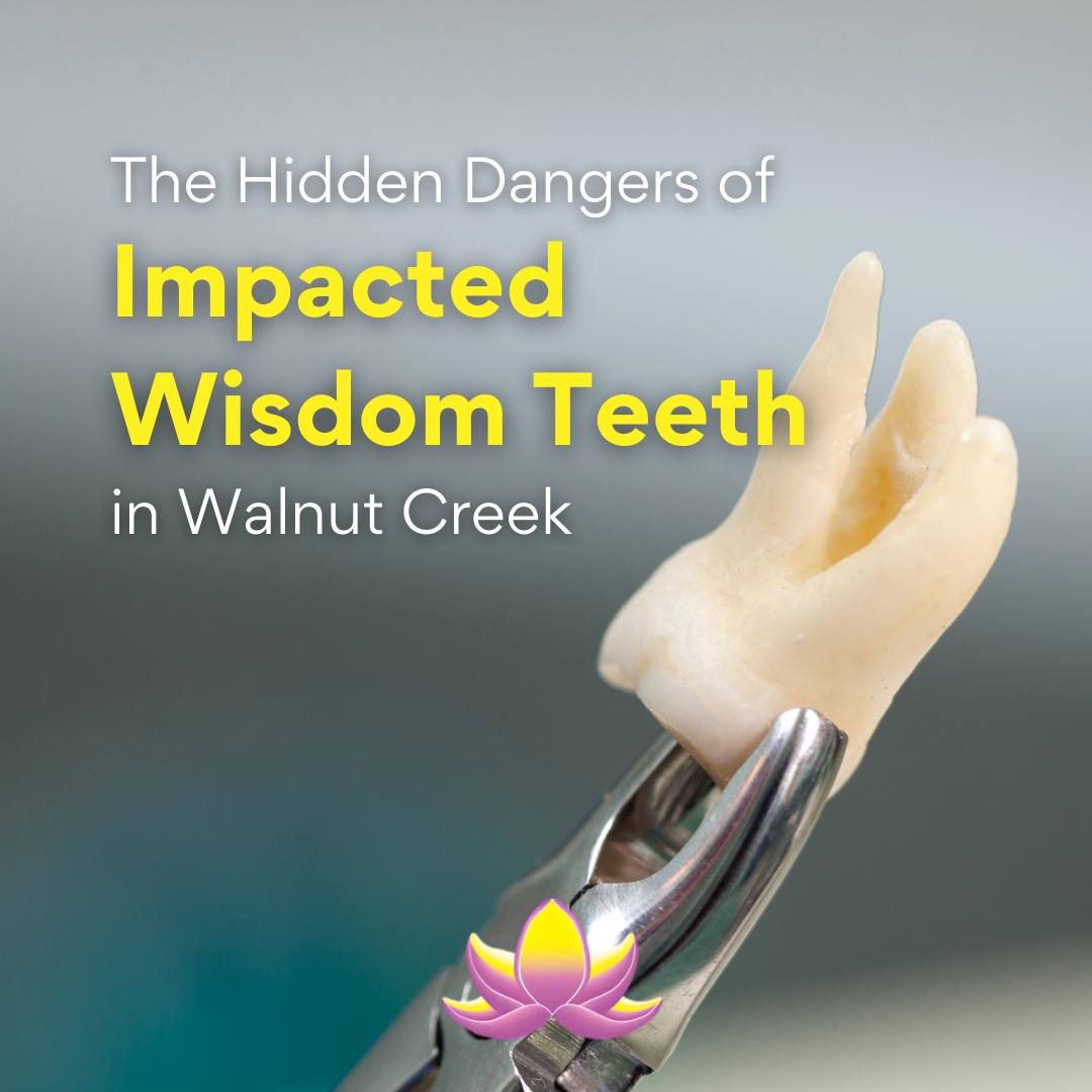The Hidden Dangers of Ignoring Impacted Wisdom Teeth in Walnut Creek ...