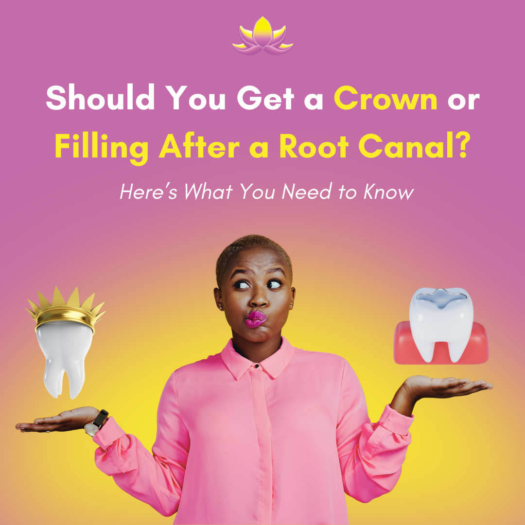 Crown or Filling After Root Canal? What to Know - Mona Lisa Smile Dental